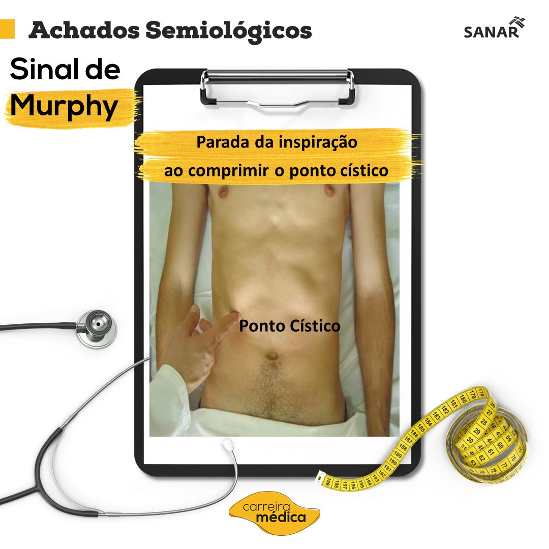 Sinal De Murphy Positivo - RETOEDU