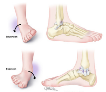 Entorses: definição, epidemiologia, mecanimos de lesão, tratamento e ...