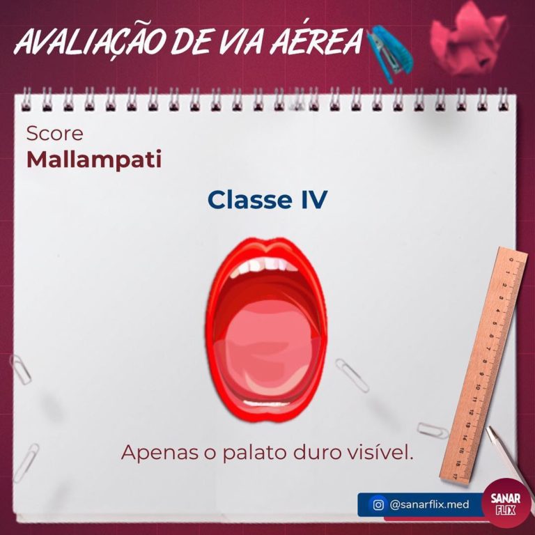 Escala de Mallampati - Sanarmed