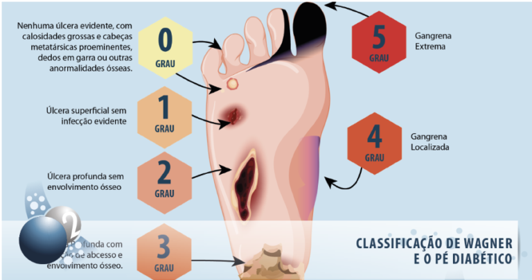 Pés Diabéticos: autocuidado previne agravos na saúde dos pacientes ...