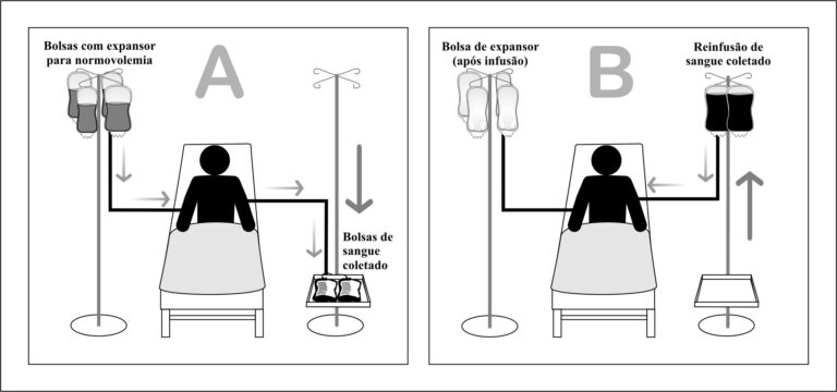 Você sabe como abordar pacientes que recusam transfusão sanguínea ...