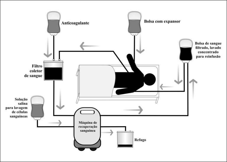 Você sabe como abordar pacientes que recusam transfusão sanguínea ...
