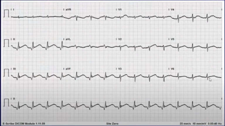 Síncope: aprenda o manejo adequado do paciente - Sanarmed