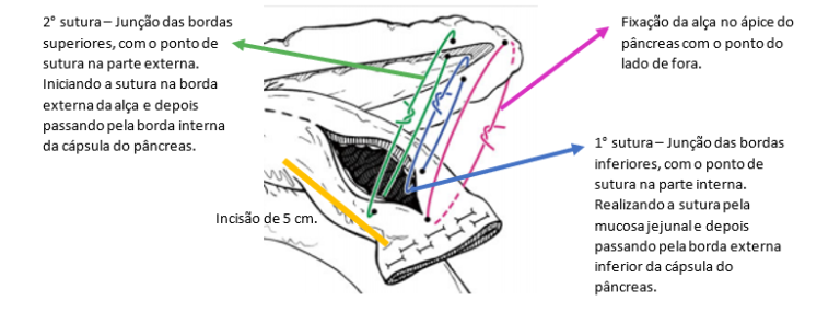 Procedimento de Puestow | Colunistas - Sanarmed