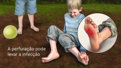 Tétano, o que é preciso saber! | Colunistas - Sanarmed