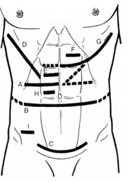 McBurney e outras incisões abdominais: Sanar, me socorre! | Colunistas ...
