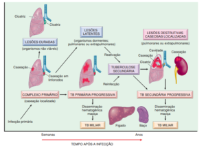 O mínimo que você precisa saber sobre Tuberculose na vida e na medicina ...