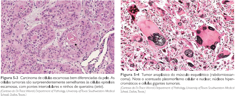 Características e nomenclatura das neoplasias | Colunistas - Sanarmed