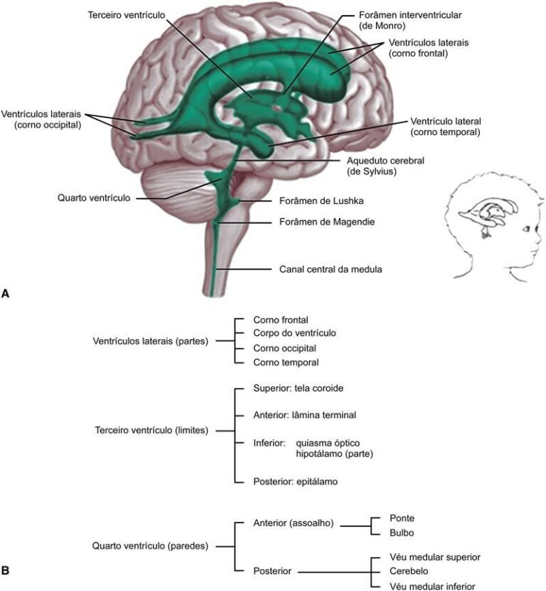 Resumo da hidrocefalia: causas e consequências | Colunistas - Sanarmed