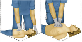 Resumo de PALS: Suportes básicos e avançados de Vida em Pediatria ...