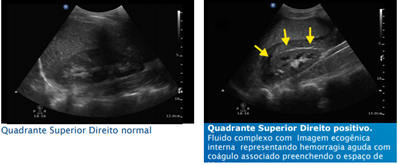 Protocolo FAST | Colunistas - Sanarmed