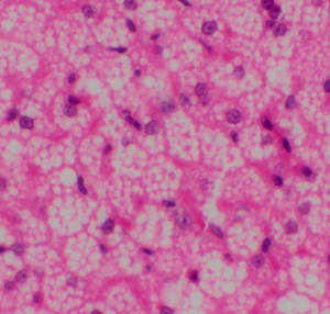 Tecido adiposo multilocular e termogênese | Colunistas - Sanarmed
