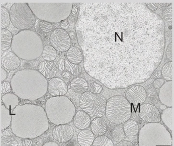 Tecido adiposo multilocular e termogênese | Colunistas - Sanarmed