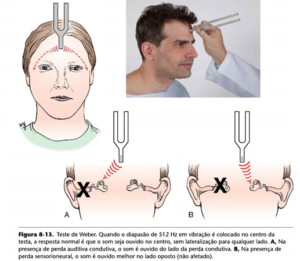 Teste de rinne e weber | Colunistas - Sanarmed