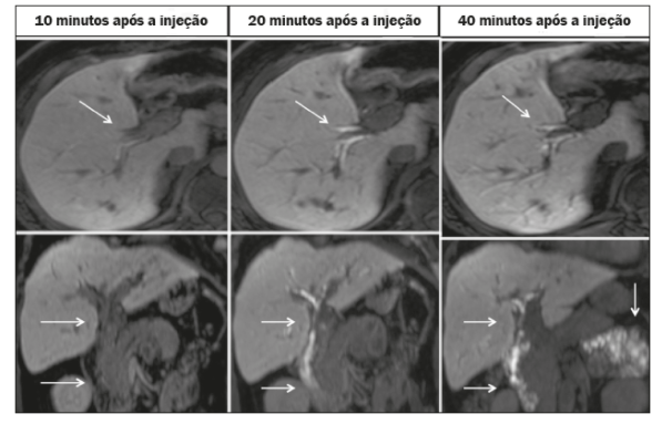 Colangiorressonância Magnética: o que o médico generalista precisa ...