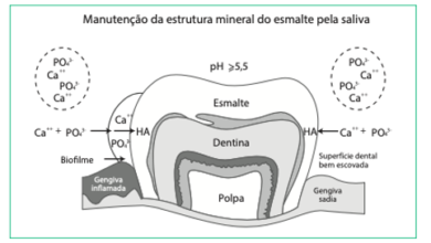 Fluorose dentária em criança | Colunistas - Sanarmed