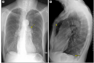 301 Moved Permanently