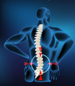 Hiperlordose e hipolordose: causas, formas de manejar e mais - Sanarmed