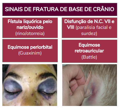 TCE: entenda sua classificação, tipos de lesões e mais - Sanarmed