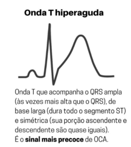 Como identificar um infarto? - Sanarmed