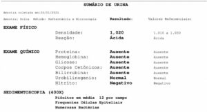 Sumário de urina: saiba tudo sobre esse exame de urina - Sanarmed