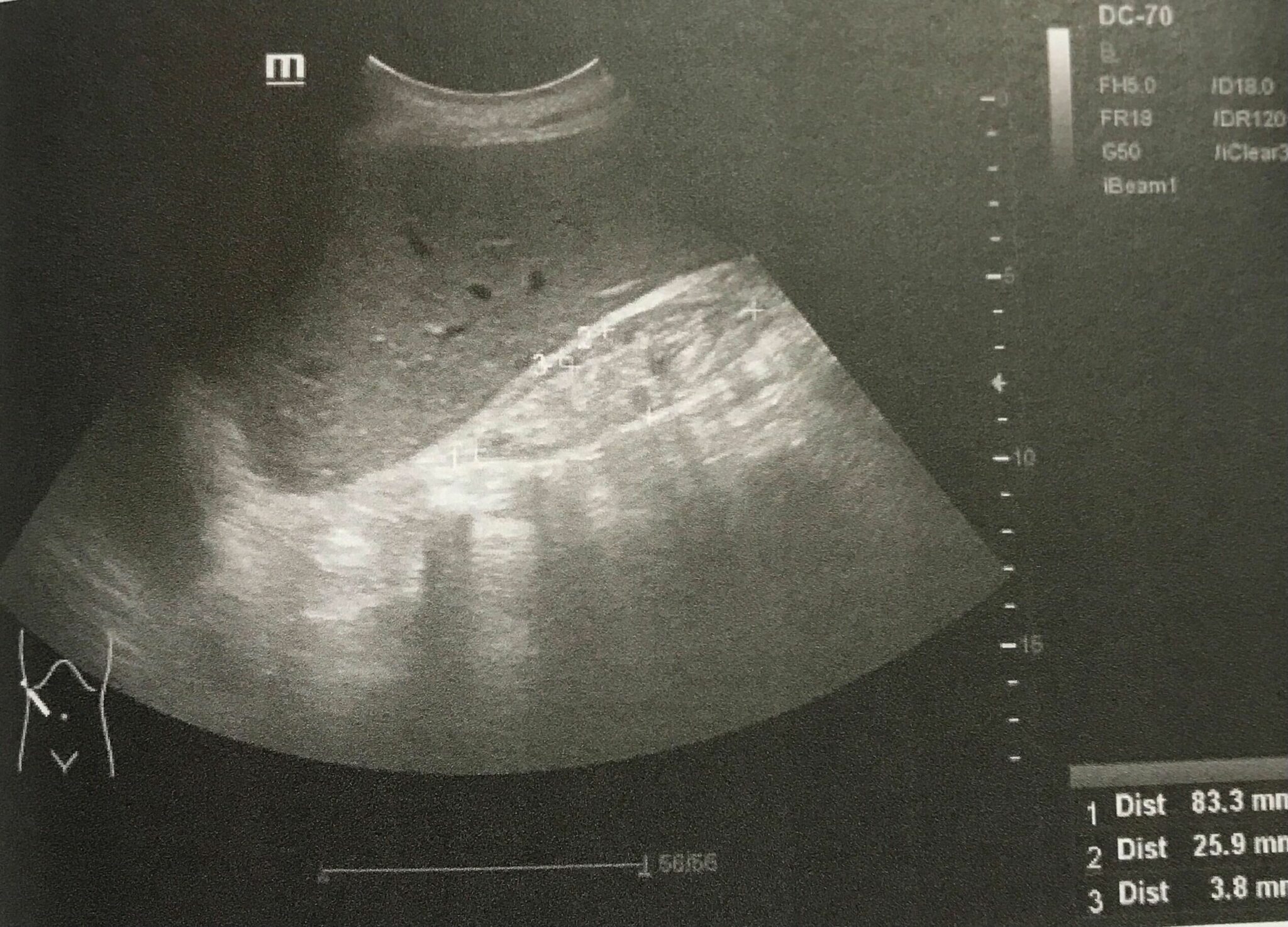 Cid Usg Abdome Total - RETOEDU