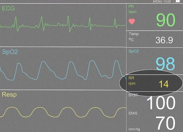 Monitoramento contínuo na UTI: guia completo com orientações - Sanarmed
