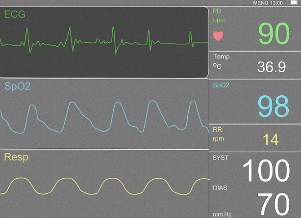 Monitoramento contínuo na UTI: guia completo com orientações - Sanarmed